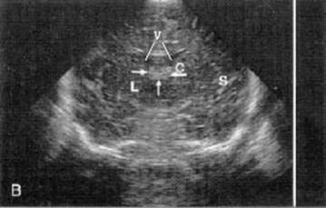 NICU Rotation Goals For Residents Alan R